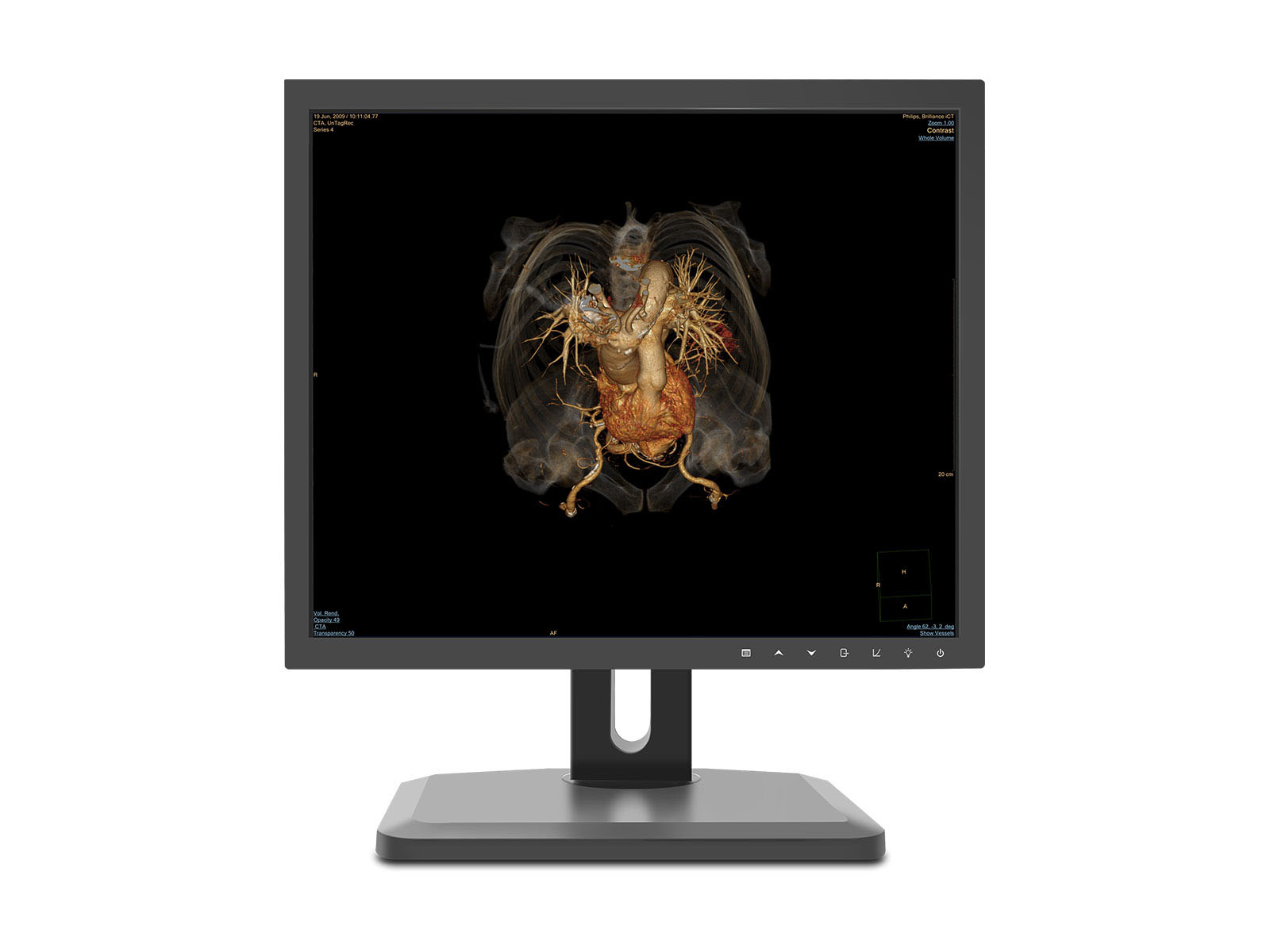 19 Inches Diagnostic Radiology Display – GTUOXIES