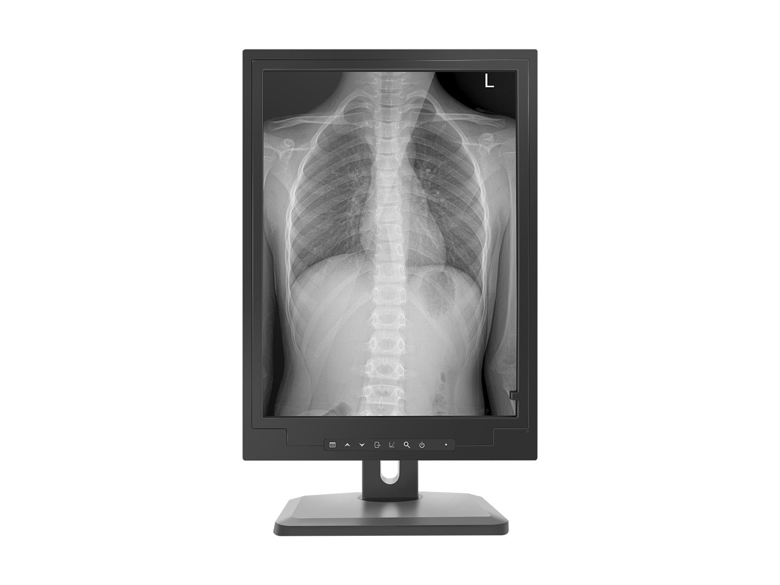 20 Inches Diagnostic Radiology Display – GTUOXIES