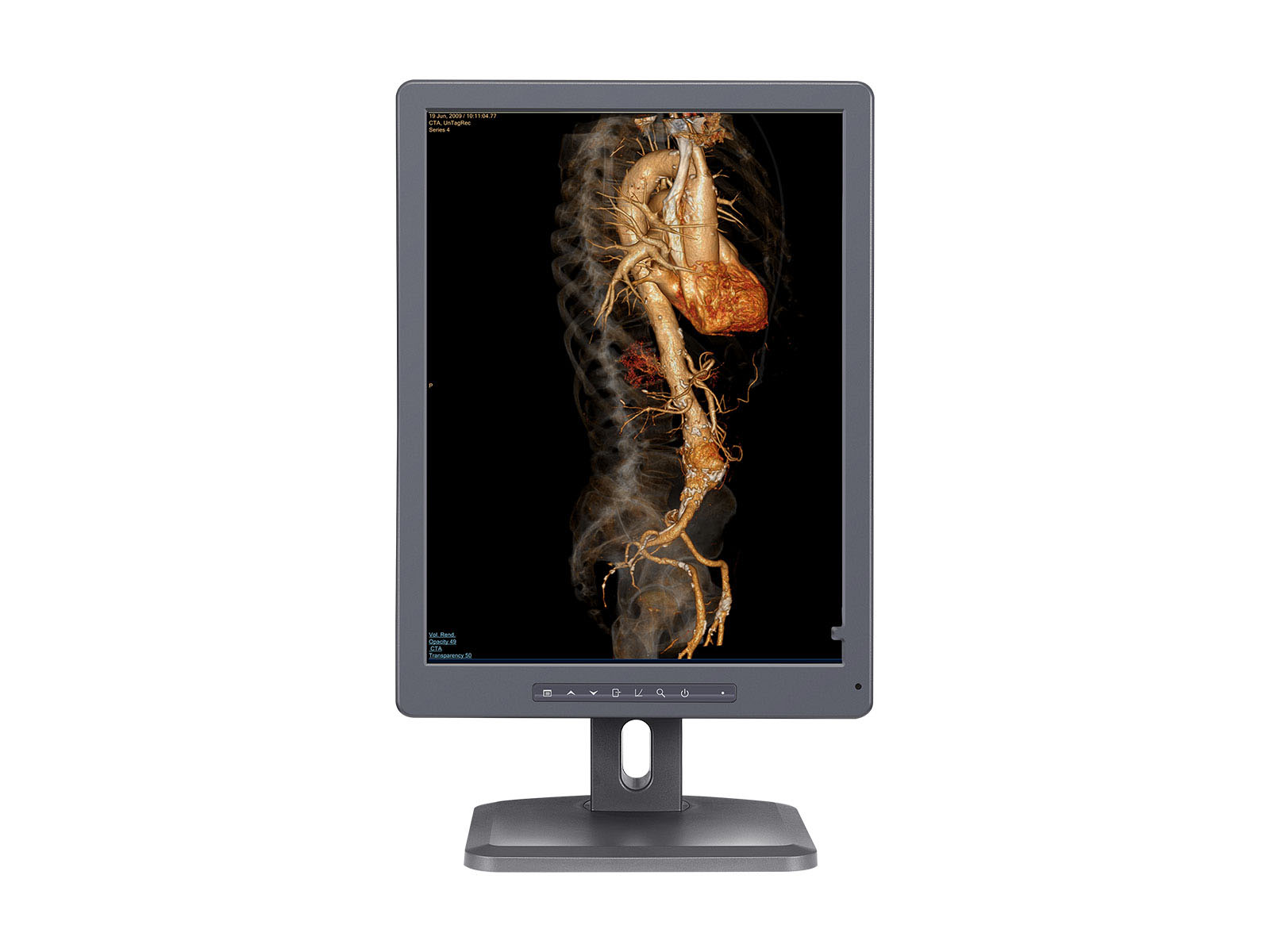 21 Inches Diagnostic Radiology Display – GTUOXIES