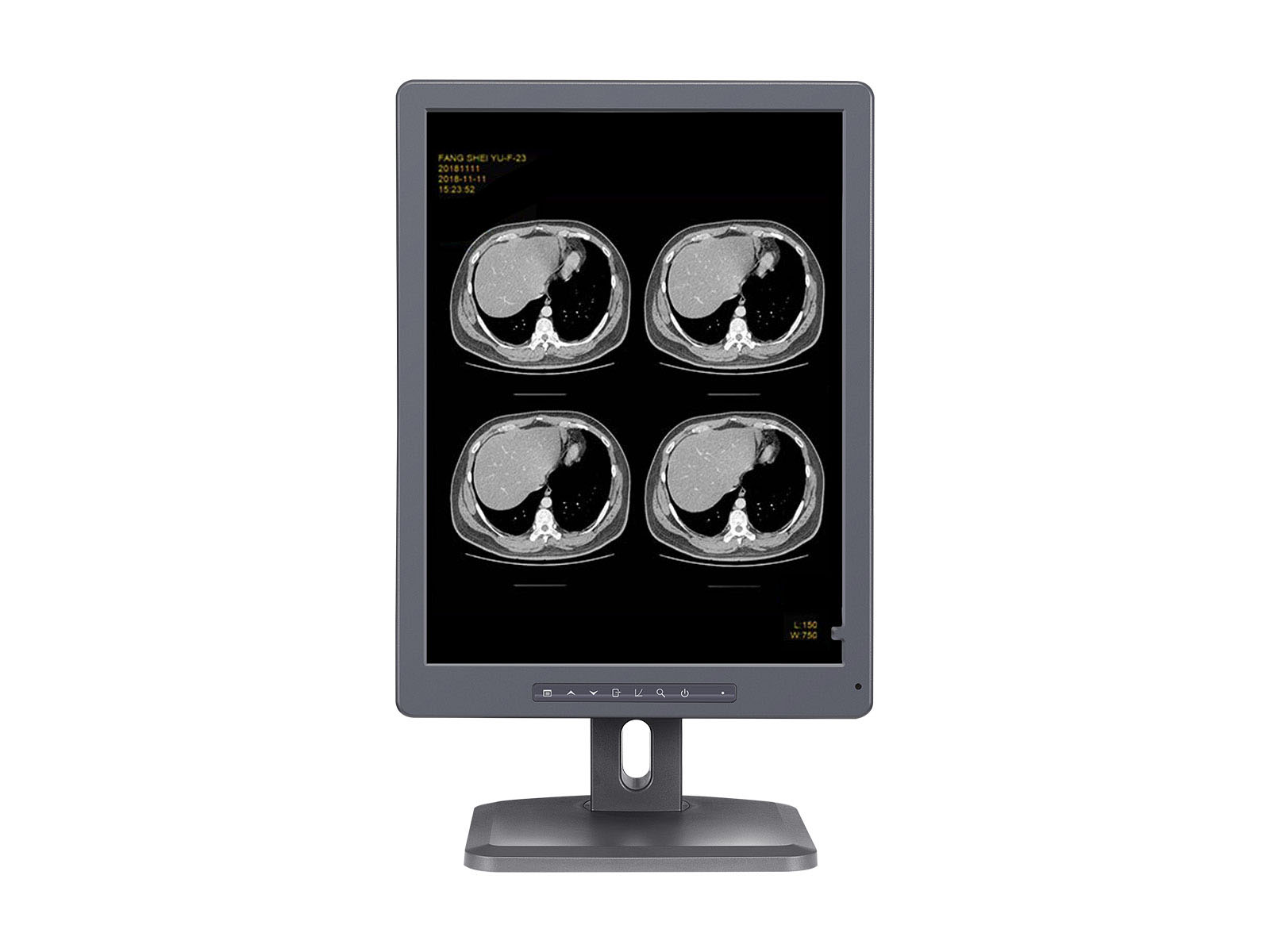 21 Inches Diagnostic Radiology Display – GTUOXIES