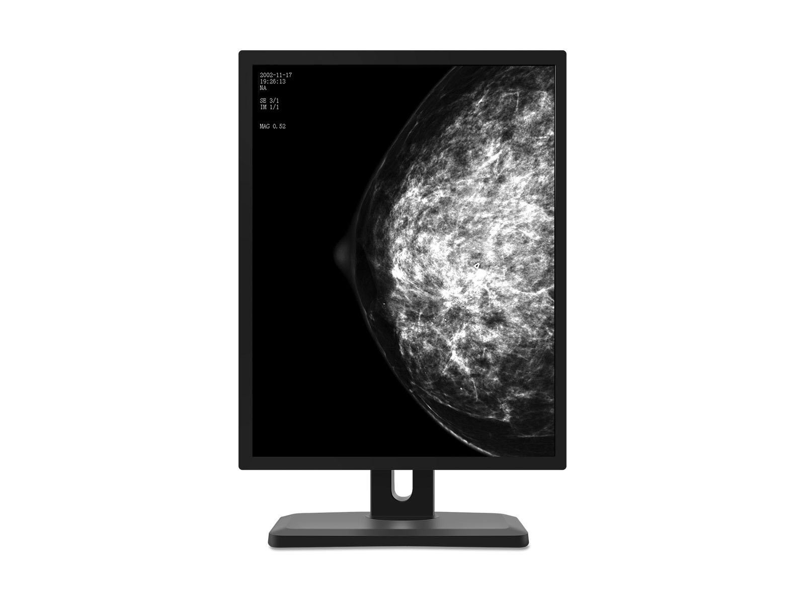 21 Inches Diagnostic Radiology Display – GTUOXIES