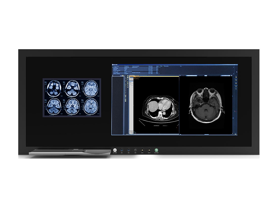 43 Inches Integrated Display in Operating Room – GTUOXIES