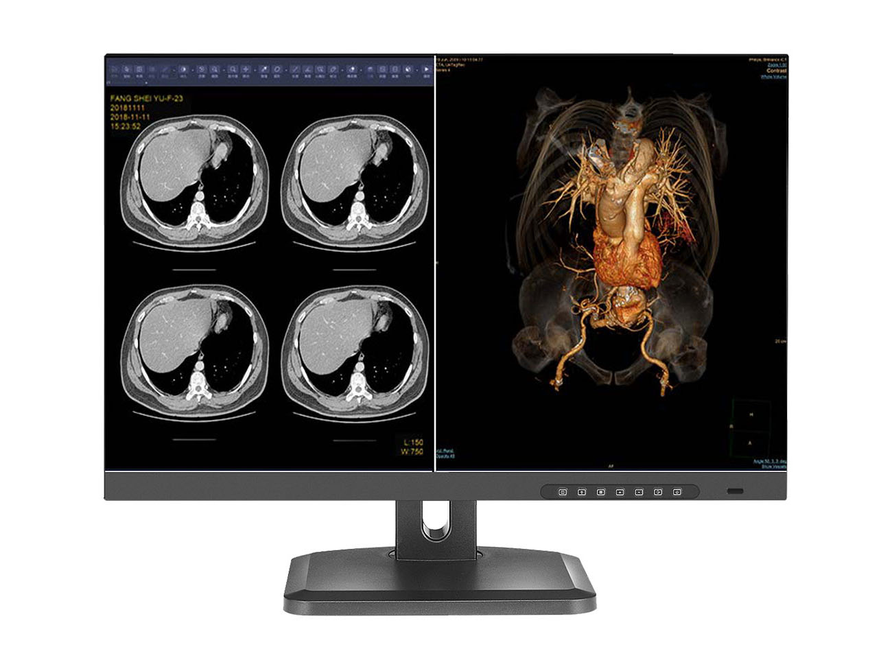 27 Inches Radiation Integrated Display – GTUOXIES