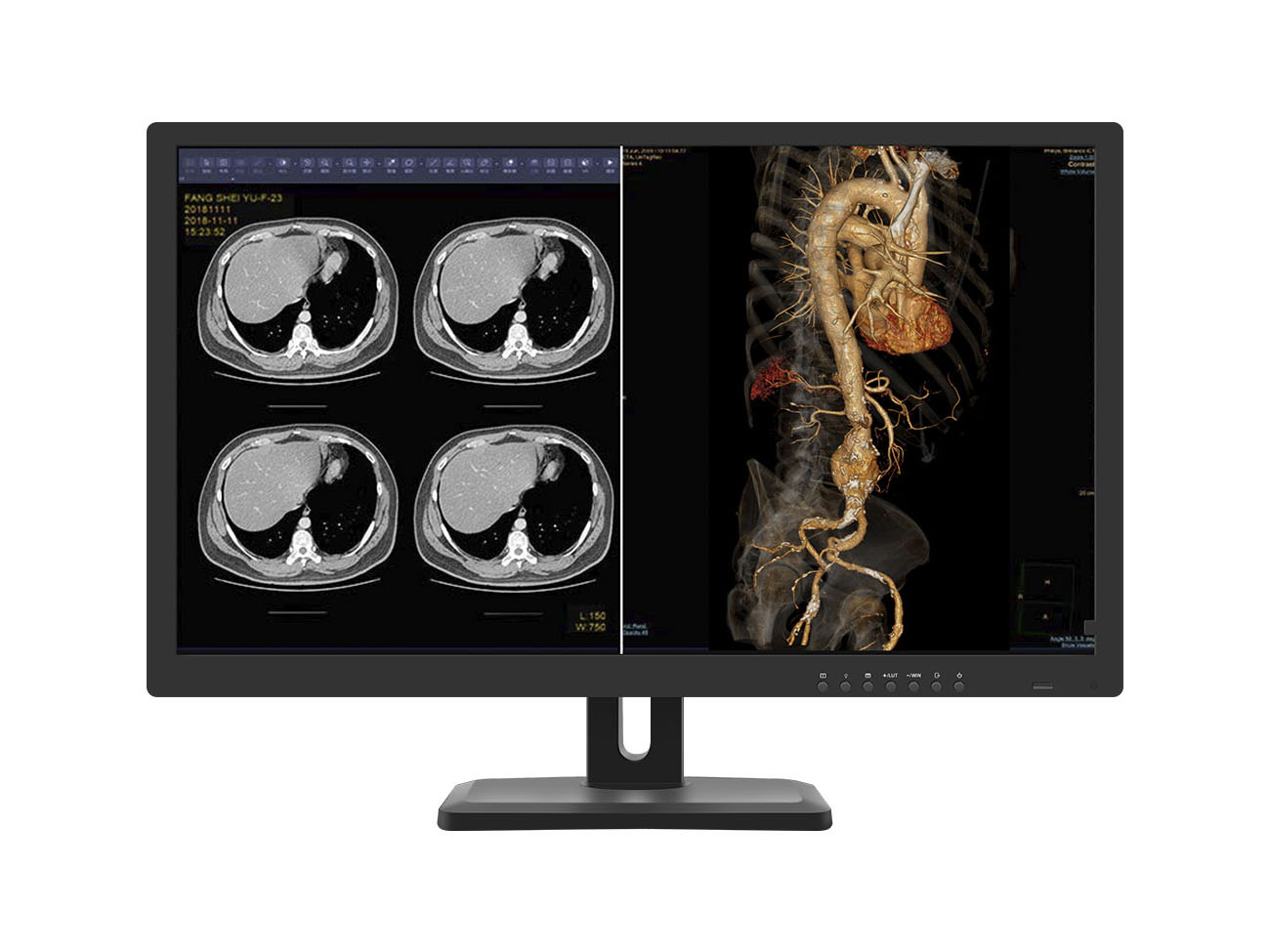 31.5 Inches Radiation Integrated Display – GTUOXIES